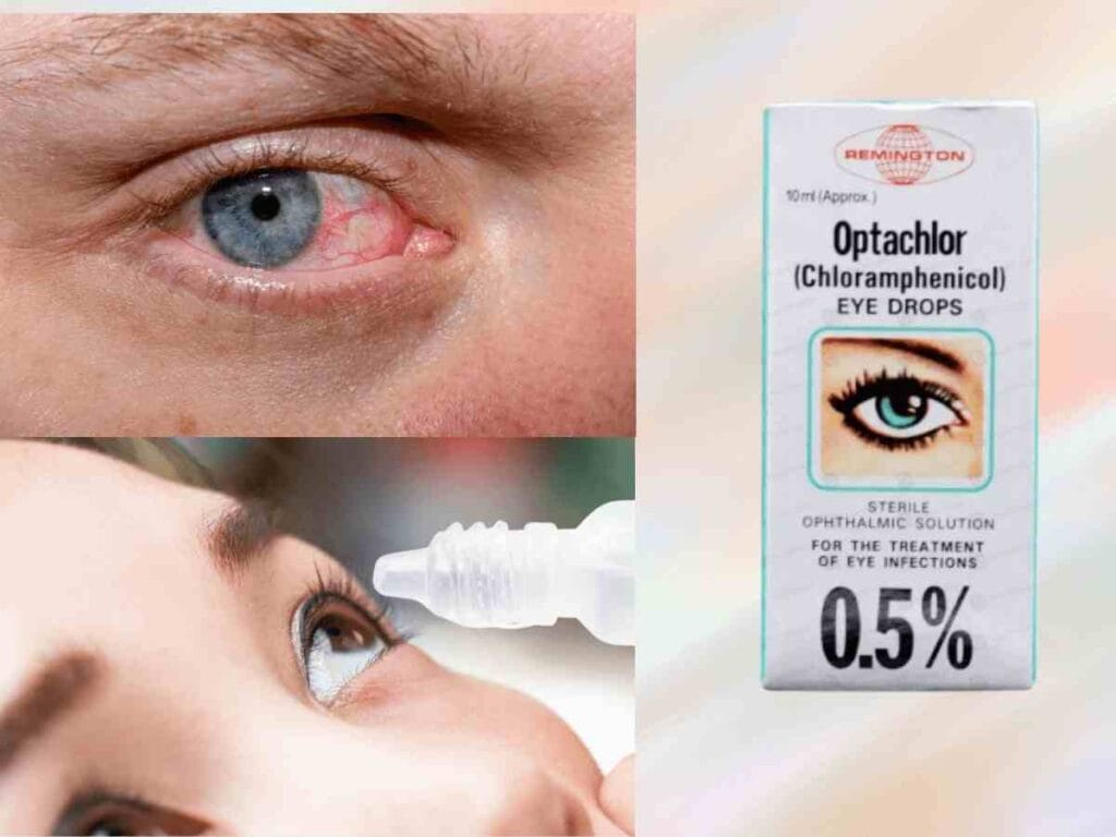 Optachlor Eye Drops: Uses, and Application Guide for Instant Relief